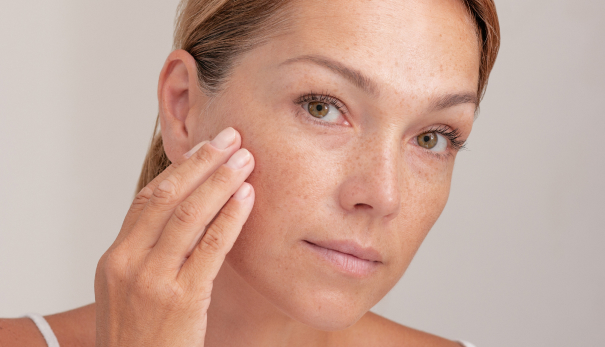 Best Treatments for Sun Damage & Dark Spots | Dr Sarhan | Guilford ...